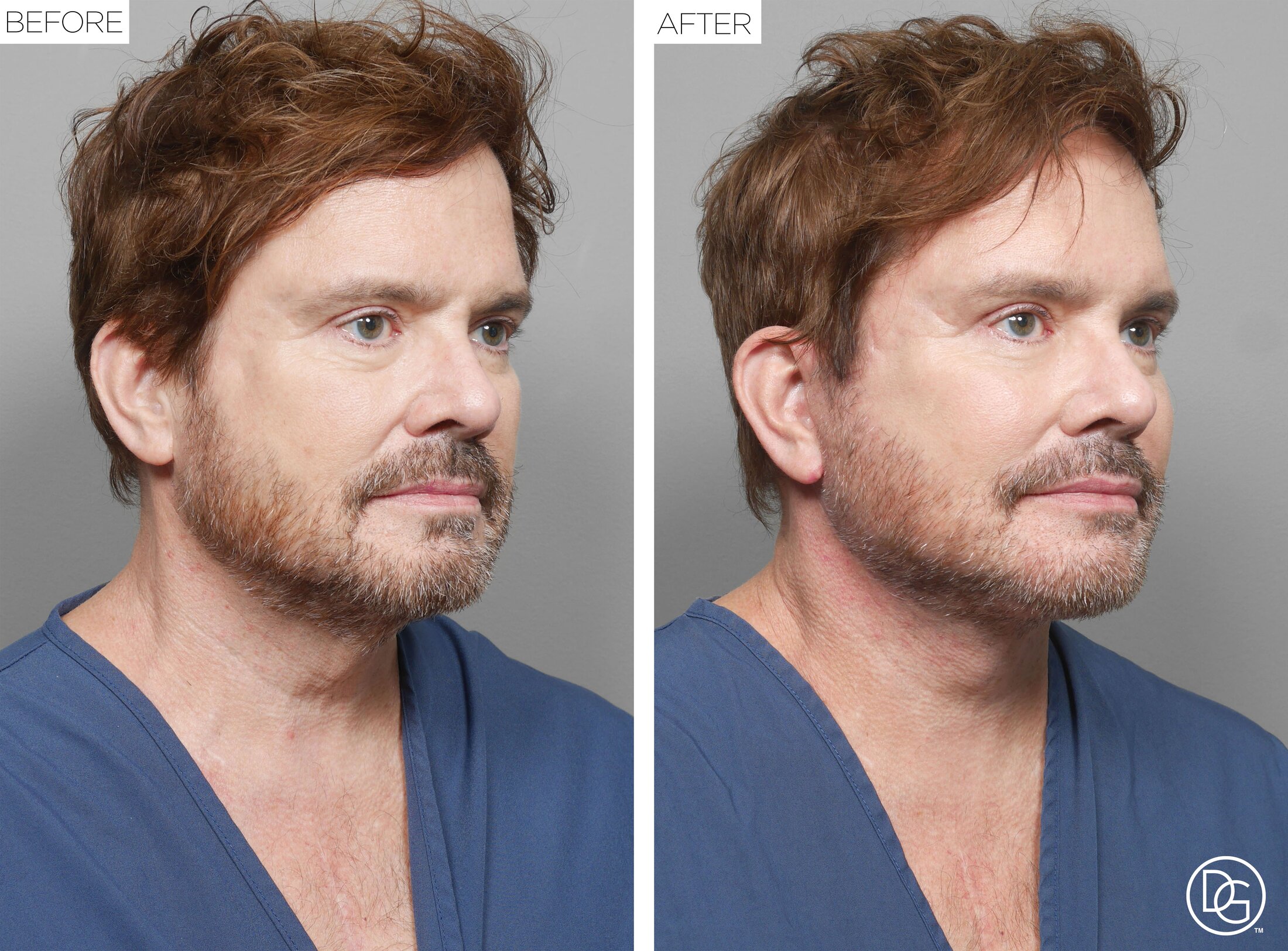 Plastic Surgery Beverly Hills | Dr. Daniel Gould Plastic Surgery